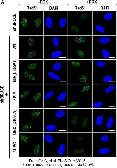Rad51抗体 [N1C2] (GTX100469) | GeneTex中国官方网站