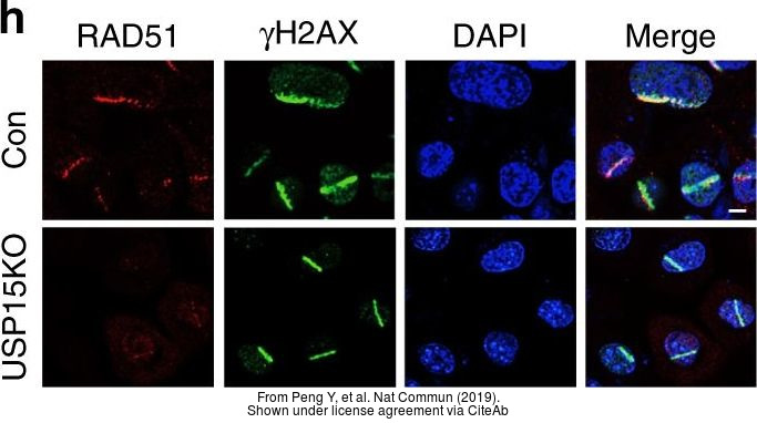 Rad51抗体 [N1C2] (GTX100469) | GeneTex中国官方网站