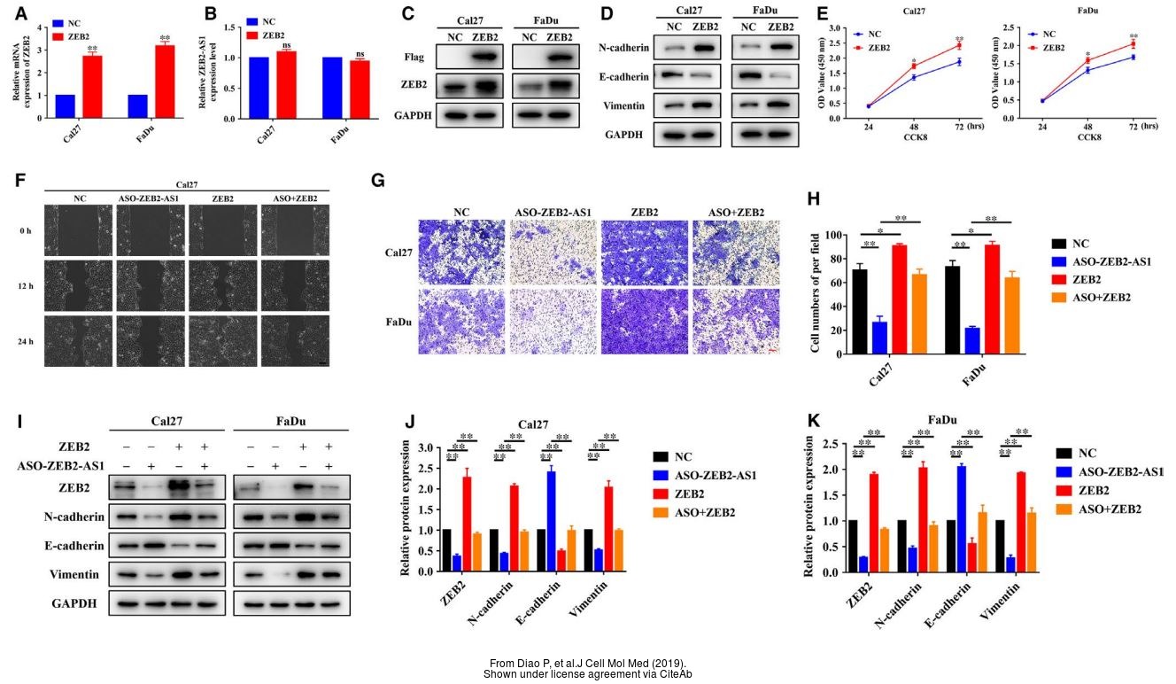 Vimentin抗体 (GTX100619) | GeneTex中国官方网站