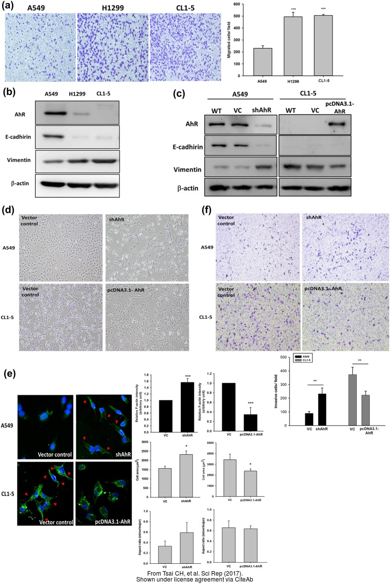 Vimentin抗体 (GTX100619) | GeneTex中国官方网站