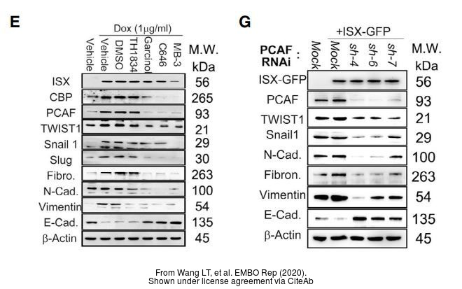 Vimentin抗体 (GTX100619) | GeneTex中国官方网站