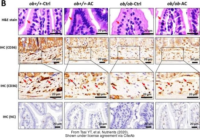 CD36抗体 [C1C3] (GTX100642) | GeneTex中国官方网站