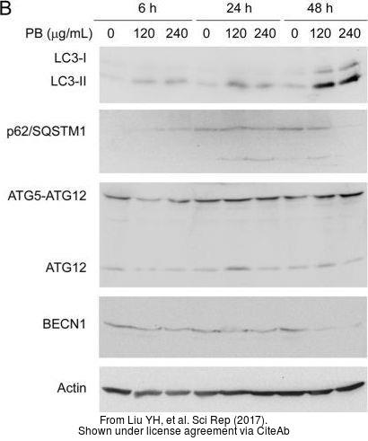 SQSTM1 / P62抗体 [N3C1], Internal (GTX100685) | GeneTex中国官方网站