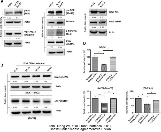 SQSTM1 / P62抗体 [N3C1], Internal (GTX100685) | GeneTex中国官方网站