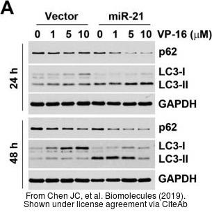 SQSTM1 / P62抗体 [N3C1], Internal (GTX100685) | GeneTex中国官方网站