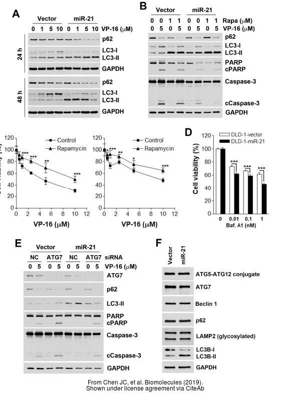 SQSTM1 / P62抗体 [N3C1], Internal (GTX100685) | GeneTex中国官方网站