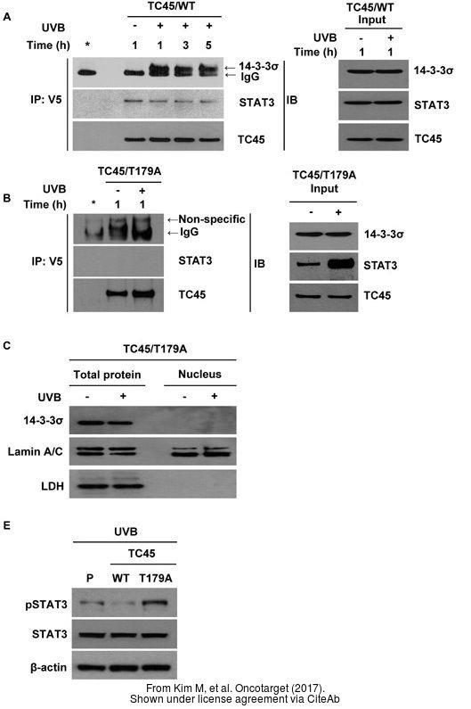 14-3-3 sigma抗体 (GTX100801) | GeneTex中国官方网站