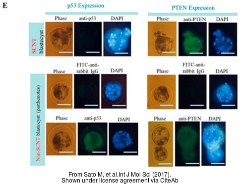 PTEN抗体 (GTX101025) | GeneTex中国官方网站