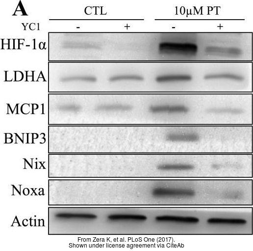 LDHA抗体 (GTX101416) | GeneTex中国官方网站