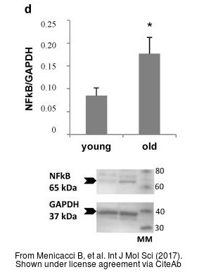 NFkB p65抗体 (GTX102090) | GeneTex中国官方网站