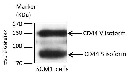 CD44抗体 (GTX102111) | GeneTex中国官方网站