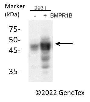 BMPR1B抗体 [N3C3] (GTX102453) | GeneTex中国官方网站