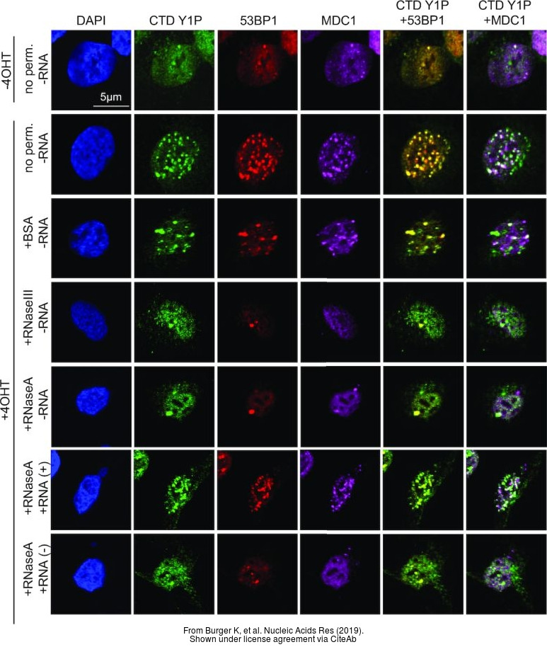 MDC1抗体 [N2N3] (GTX102673) | GeneTex中国官方网站