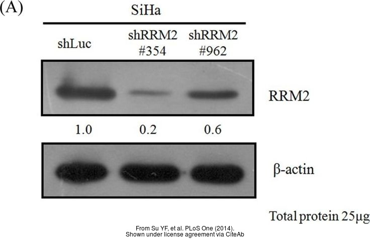RRM2抗体 [N1C1] (GTX103193) | GeneTex中国官方网站