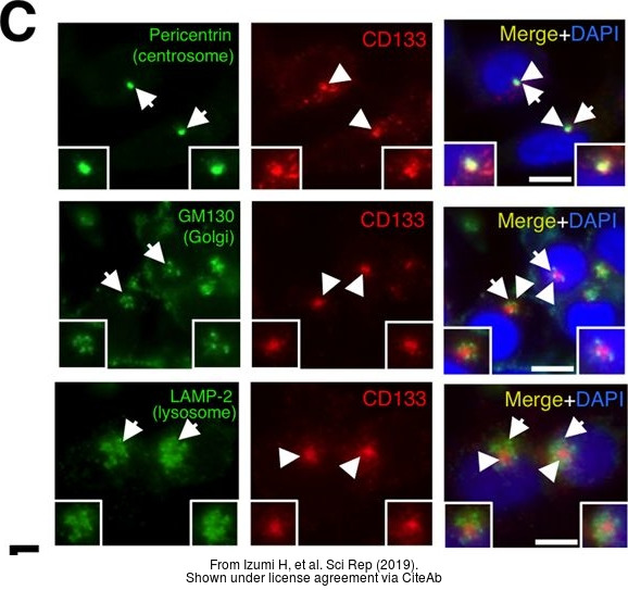 LAMP2抗体 (GTX103214) | GeneTex中国官方网站
