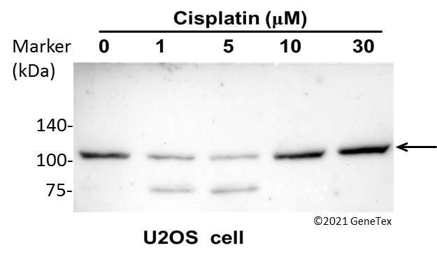 GRP94抗体 (GTX103232) | GeneTex中文官方网站
