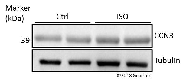 CCN3抗体 (GTX103377) | GeneTex中国官方网站
