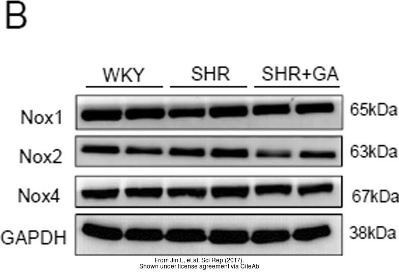 NOX1抗体 (GTX103888) | GeneTex中国官方网站