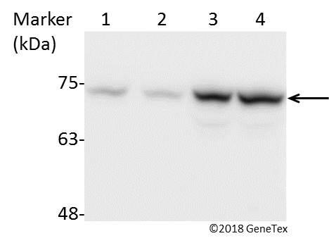 MMP2抗体 (GTX104577) | GeneTex中国官方网站