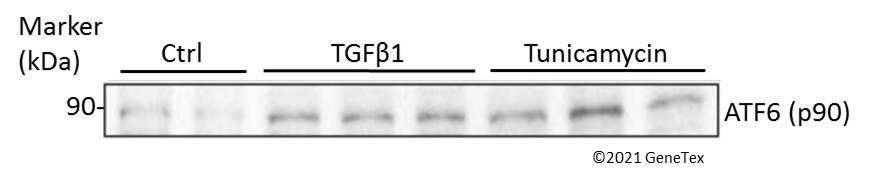 ATF6抗体 [C3], C-term (GTX104820) | GeneTex中文官方网站