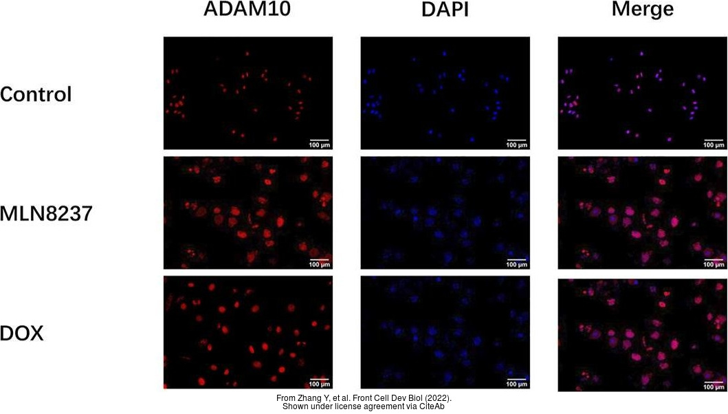 ADAM10抗体 [N2C1], Internal (GTX104940) | GeneTex中国官方网站