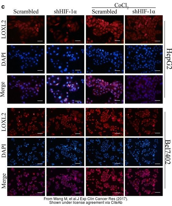 LOXL2抗体 (GTX105085) | GeneTex中国官方网站