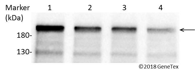 ZEB1抗体 [N2C1], Internal (GTX105278) | GeneTex中国官方网站