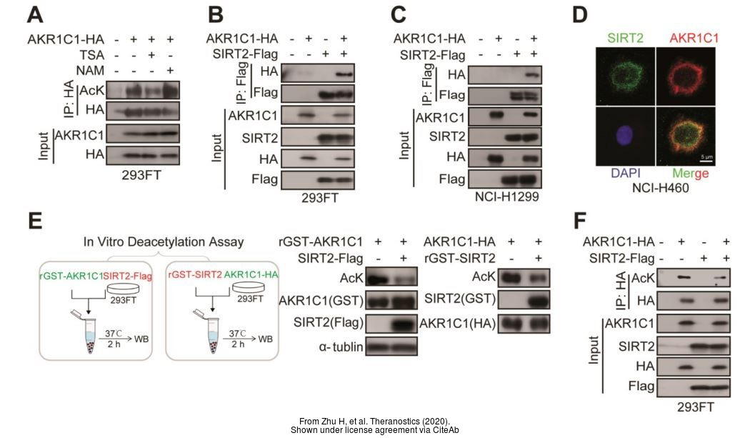 AKR1C1抗体 (GTX105620) | GeneTex中国官方网站