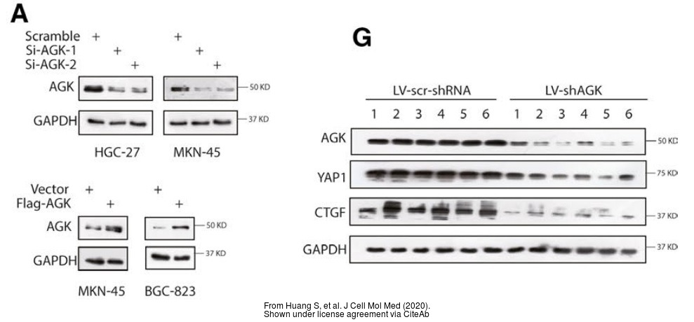 Acylglycerol kinase抗体 (GTX107413) | GeneTex中国官方网站