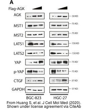 Acylglycerol kinase抗体 (GTX107413) | GeneTex中国官方网站