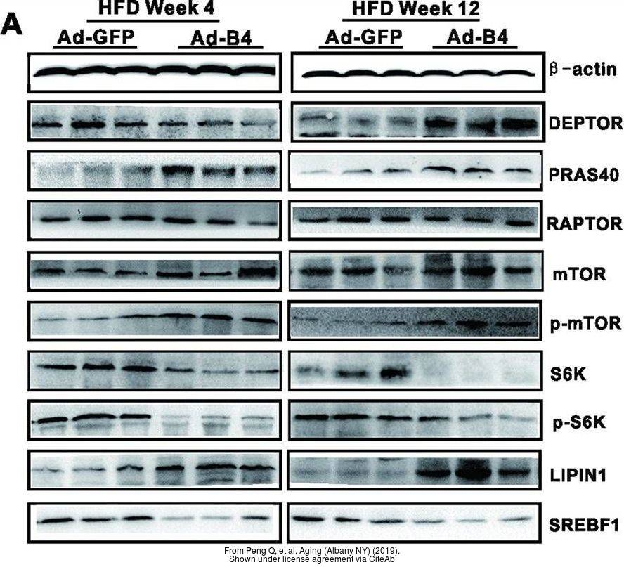 p70 S6K抗体 (GTX107562) | GeneTex中国官方网站