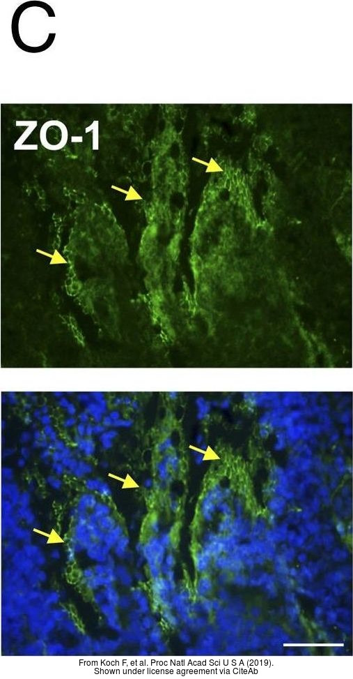 ZO-1抗体 (GTX108592) | GeneTex中国官方网站