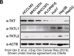 TKTL1抗体 [N1C1] (GTX109459) | GeneTex中国官方网站