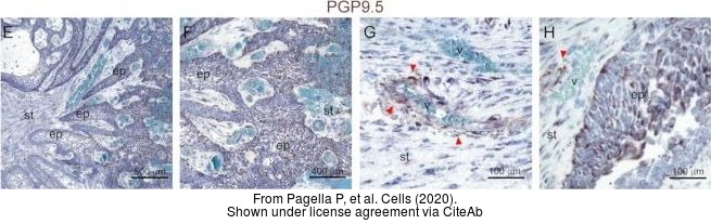 PGP9.5抗体 (GTX109637) | GeneTex中国官方网站