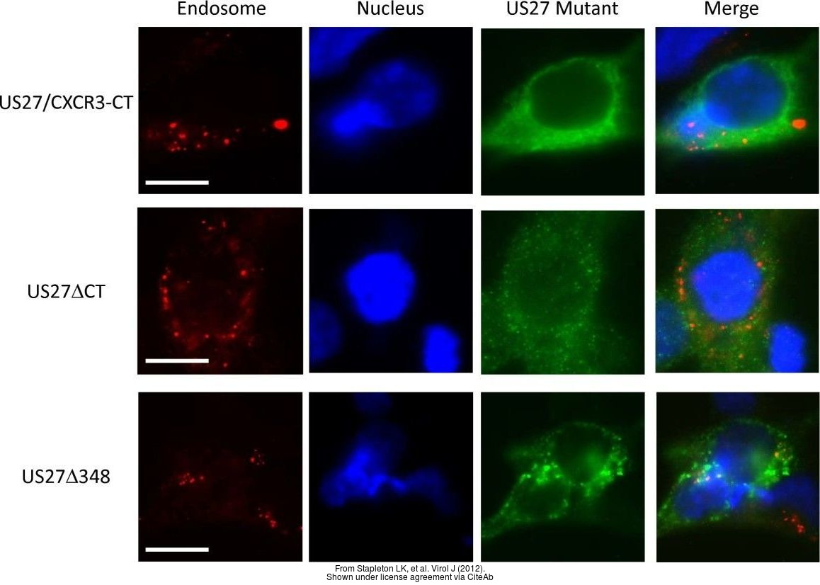 EEA1抗体 [C3], C-term (GTX109638) | GeneTex中国官方网站