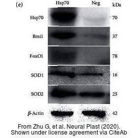 SOD2抗体 (GTX116093) | GeneTex中国官方网站