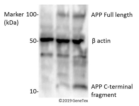 beta Actin抗体 (GTX109639) | GeneTex中文官方网站