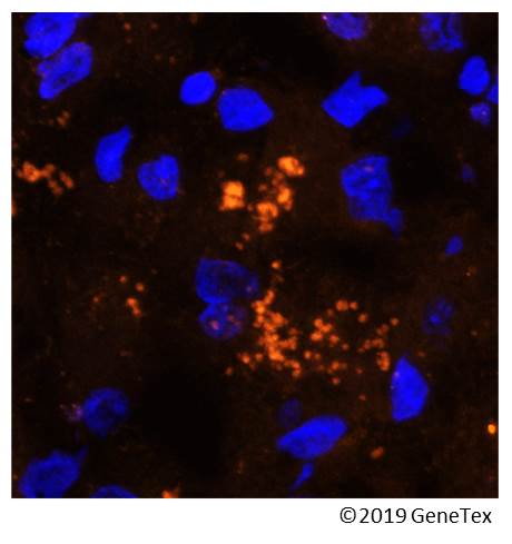 RAB5A抗体 (GTX109665) | GeneTex中文官方网站