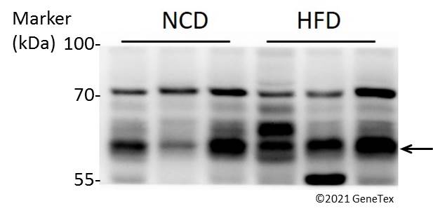 ATGL抗体 [N1C1] (GTX109941) | GeneTex中文官方网站