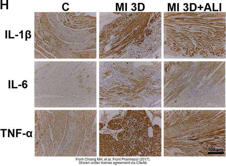 TNF alpha抗体 (GTX110520) | GeneTex中国官方网站
