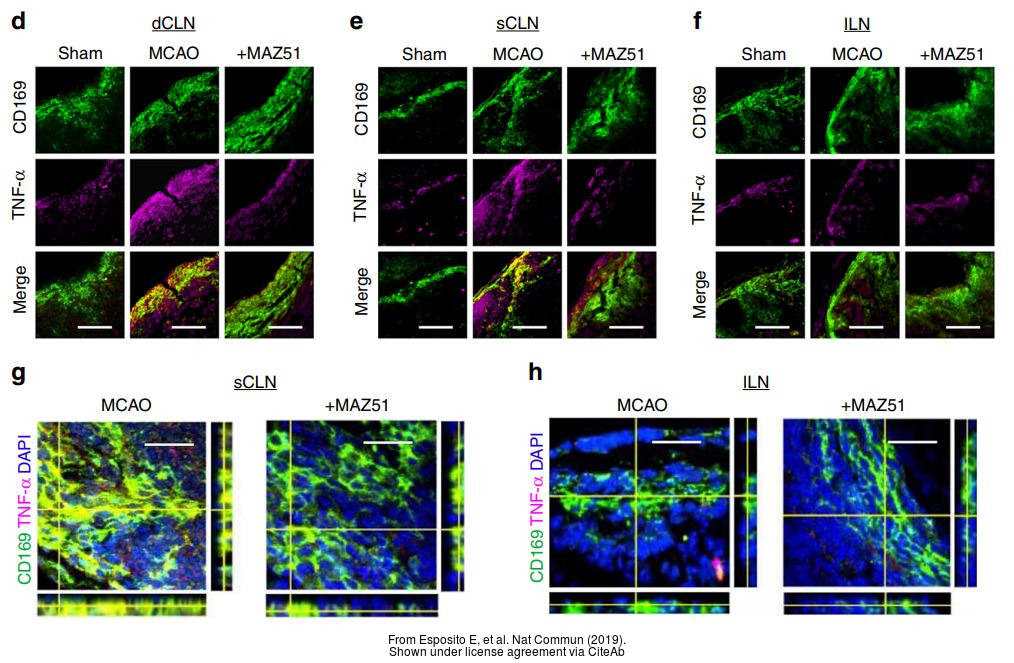 TNF alpha抗体 (GTX110520) | GeneTex中国官方网站