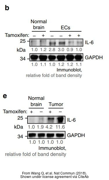 IL6抗体 (GTX110527) | GeneTex中国官方网站