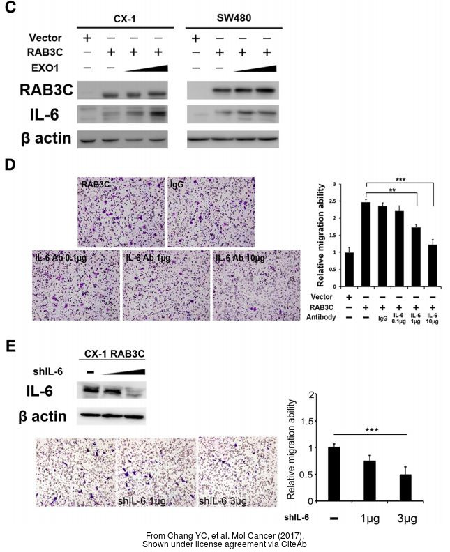 IL6抗体 (GTX110527) | GeneTex中国官方网站
