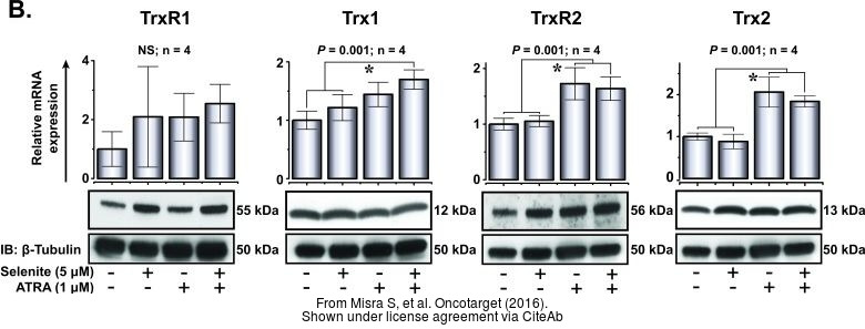 TrxR1抗体 (GTX110589) | GeneTex中国官方网站