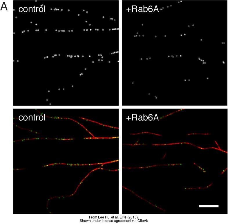 RAB6A抗体 (GTX110646) | GeneTex中国官方网站