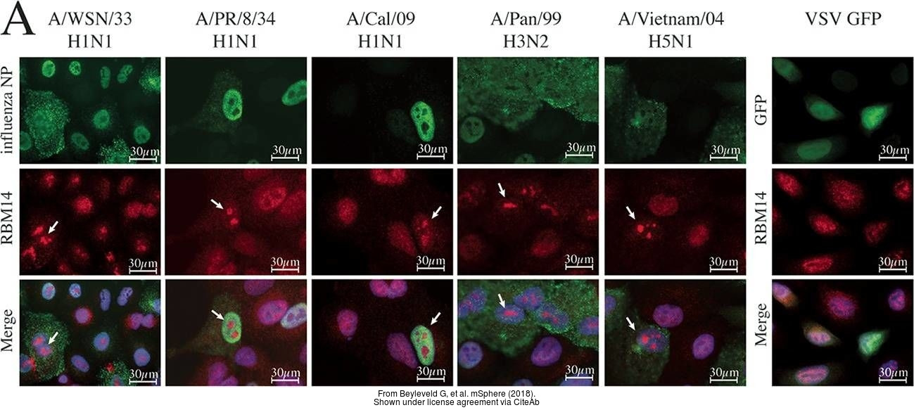 RBM14抗体 [N1N2], N-term (GTX112293) | GeneTex中国官方网站