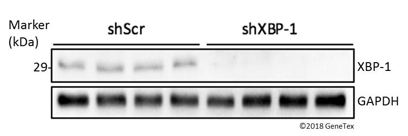 XBP1抗体 [N1C3] (GTX113295) | GeneTex中国官方网站