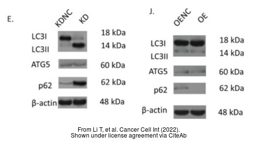 ATG5抗体 (GTX113309) | GeneTex中国官方网站
