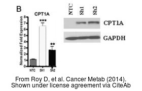 CPT1A抗体 [C1C2], Internal (GTX114337) | GeneTex中国官方网站