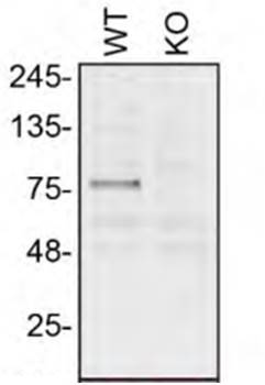 VPS35抗体 (GTX116260) | GeneTex中国官方网站